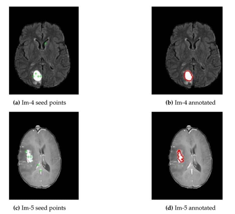 Top Image Segmentation Methods For Machine Vision